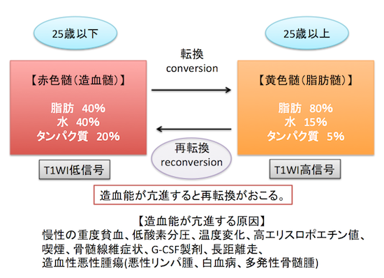 過形成骨髄＝造血髄(赤色髄)化＝再転換の画像診断、画像所見 hyperplastic bone marrow hypercellular ...